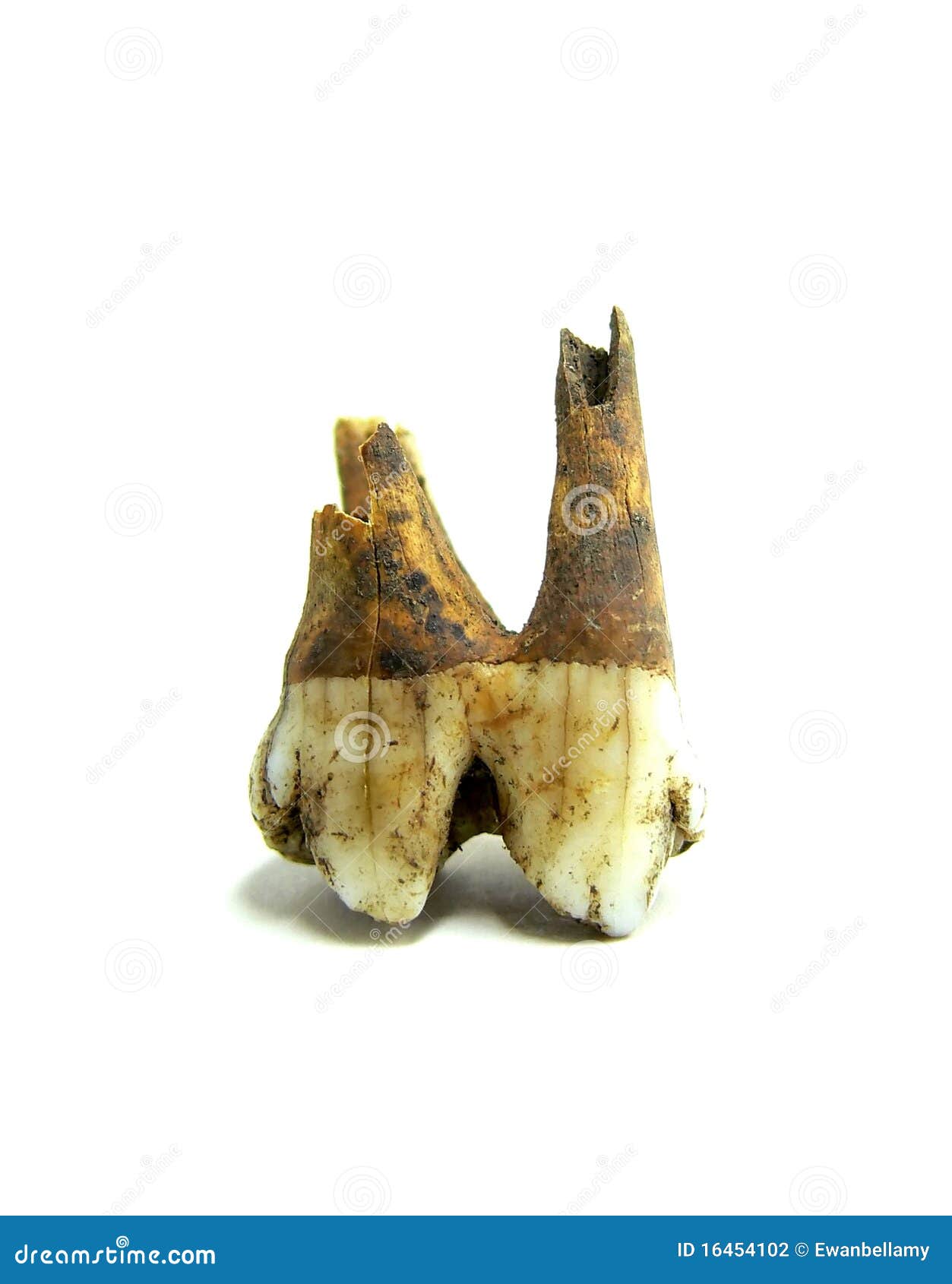 Tooth stock photo. Image of hygiene, dirt, dentistry - 16454102