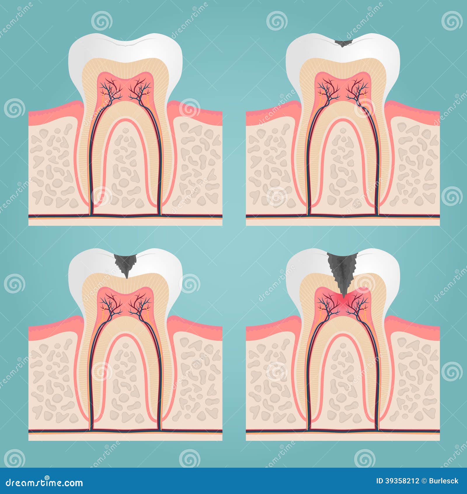 Tooth Anatomy Vector Dental Infographics | CartoonDealer.com #79346828