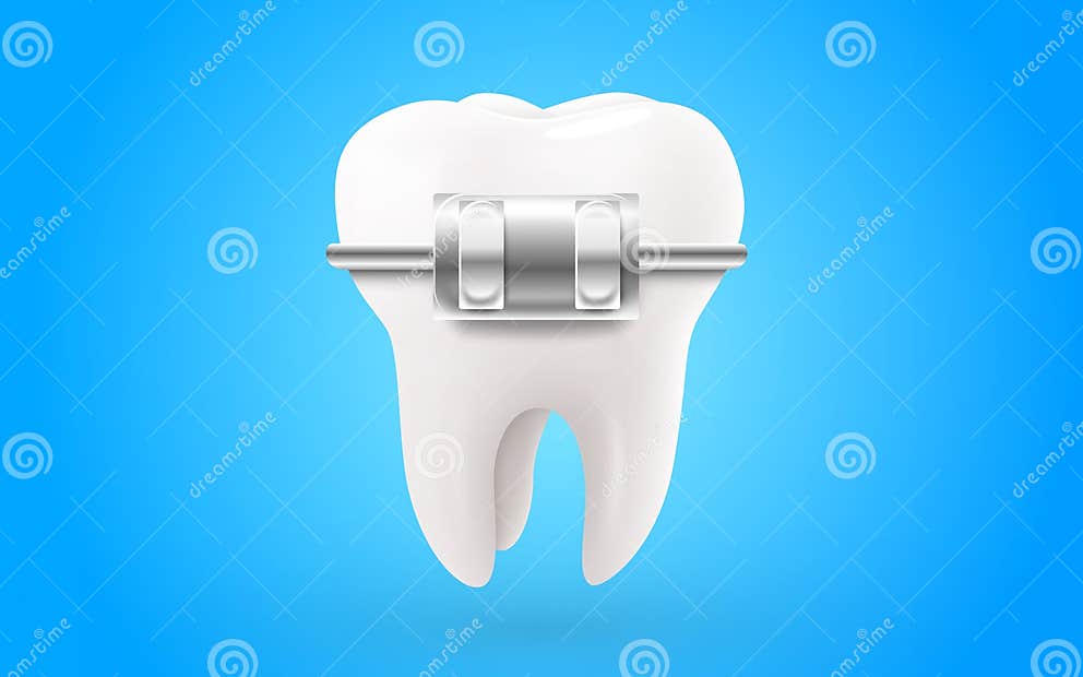 Tooth with braces. stock vector. Illustration of oral - 323418668