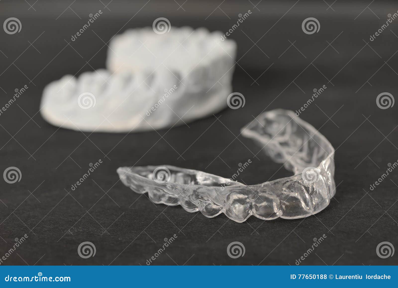 Tooth Brackets Transparent Braces Stock Photo - Image of equipment ...