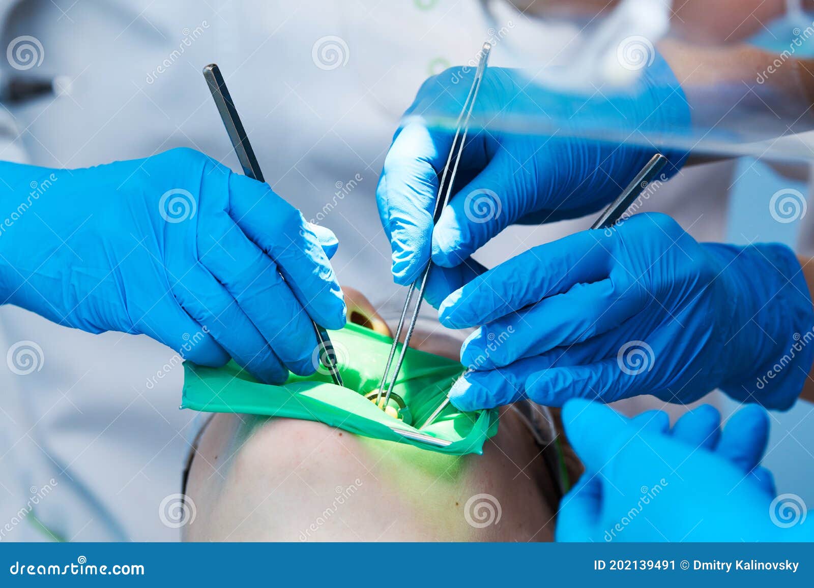 Tooth Care and Treatment. Dentist Work Stock Image - Image of clinic ...