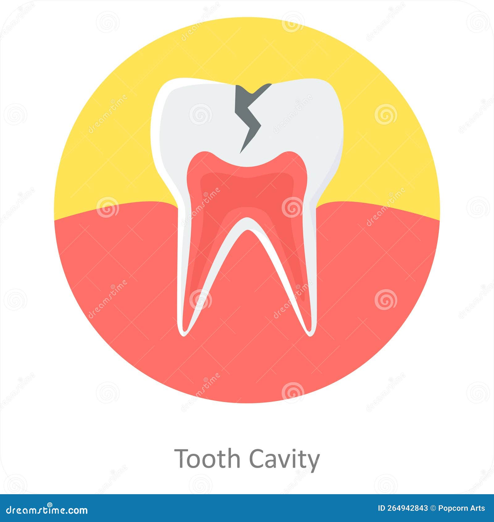 Tooth Cavity stock vector. Illustration of cavity, germs - 264942843