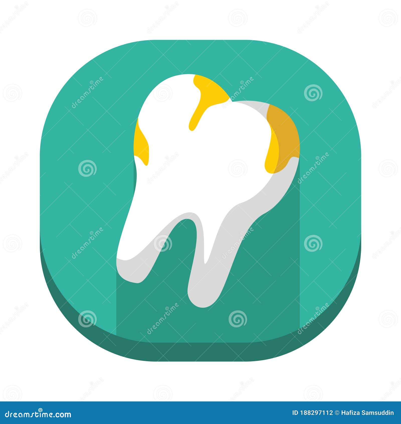 Tooth with Cavity. Vector Illustration Decorative Design Stock Vector ...