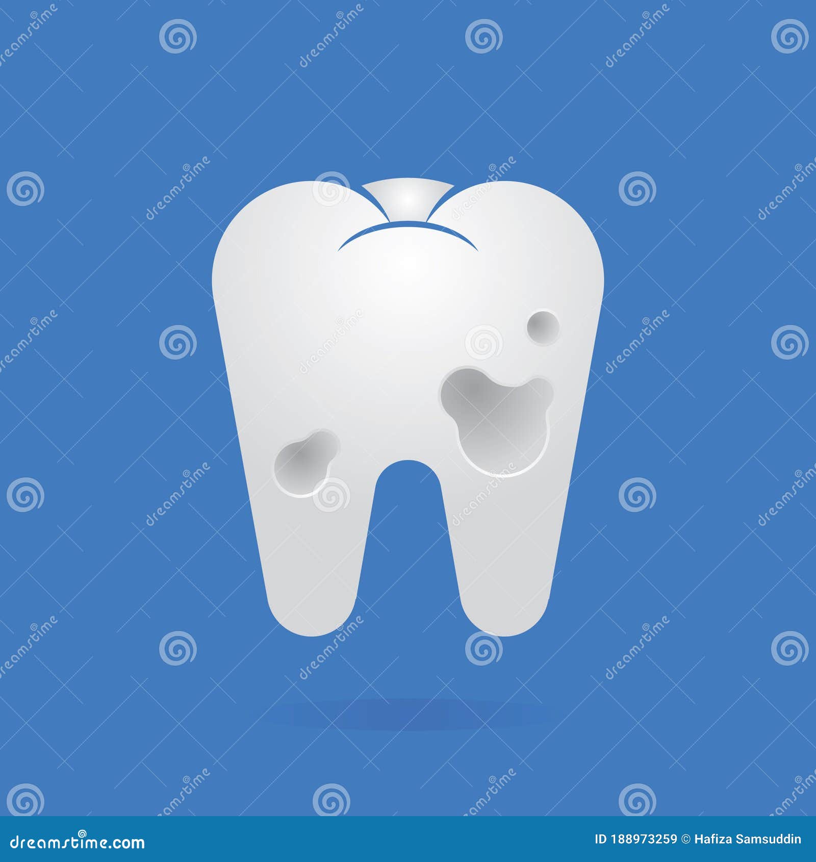 Tooth Cavity. Vector Illustration Decorative Design Stock Vector ...