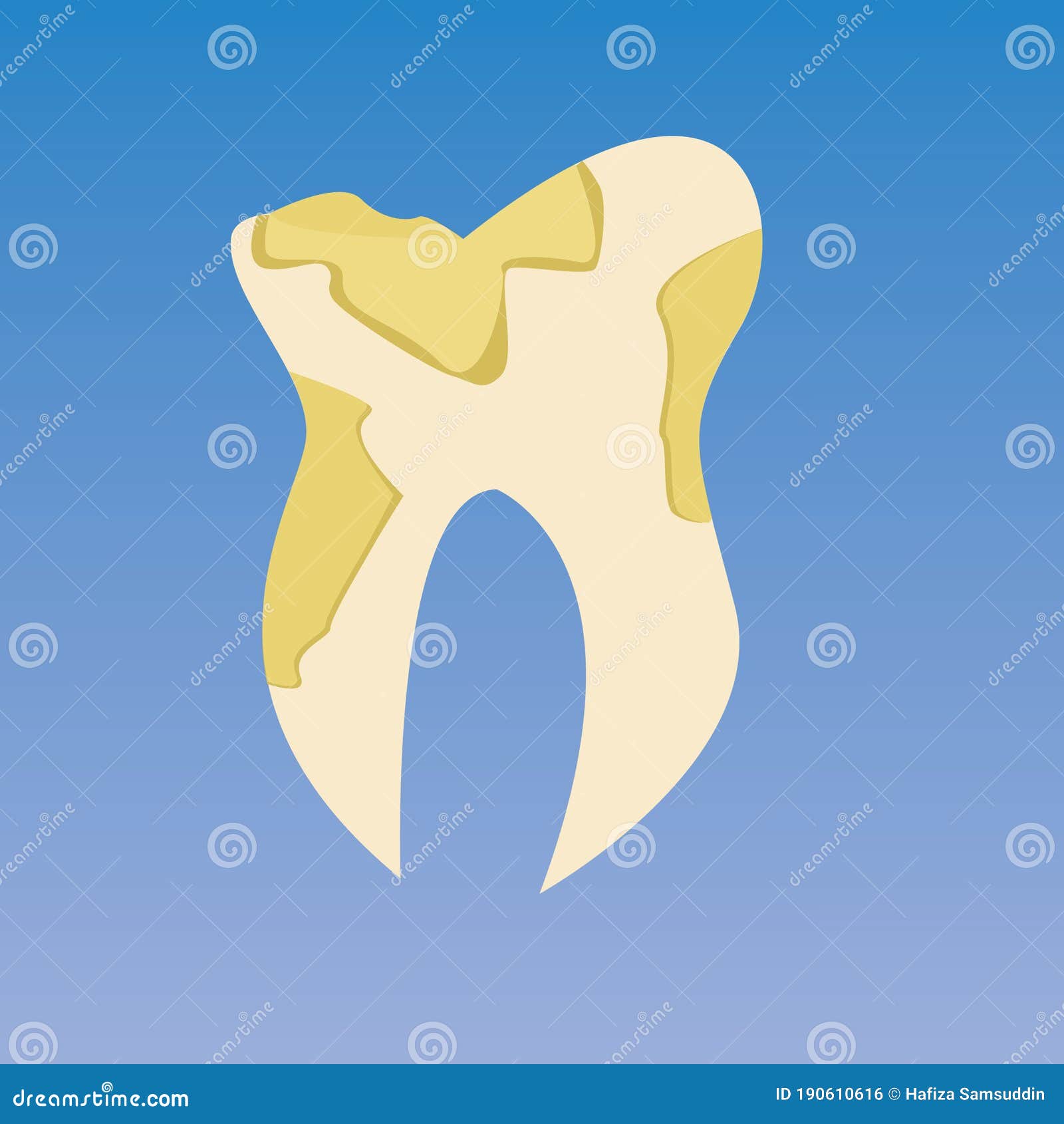 Tooth with Cavity. Vector Illustration Decorative Design Stock Vector ...