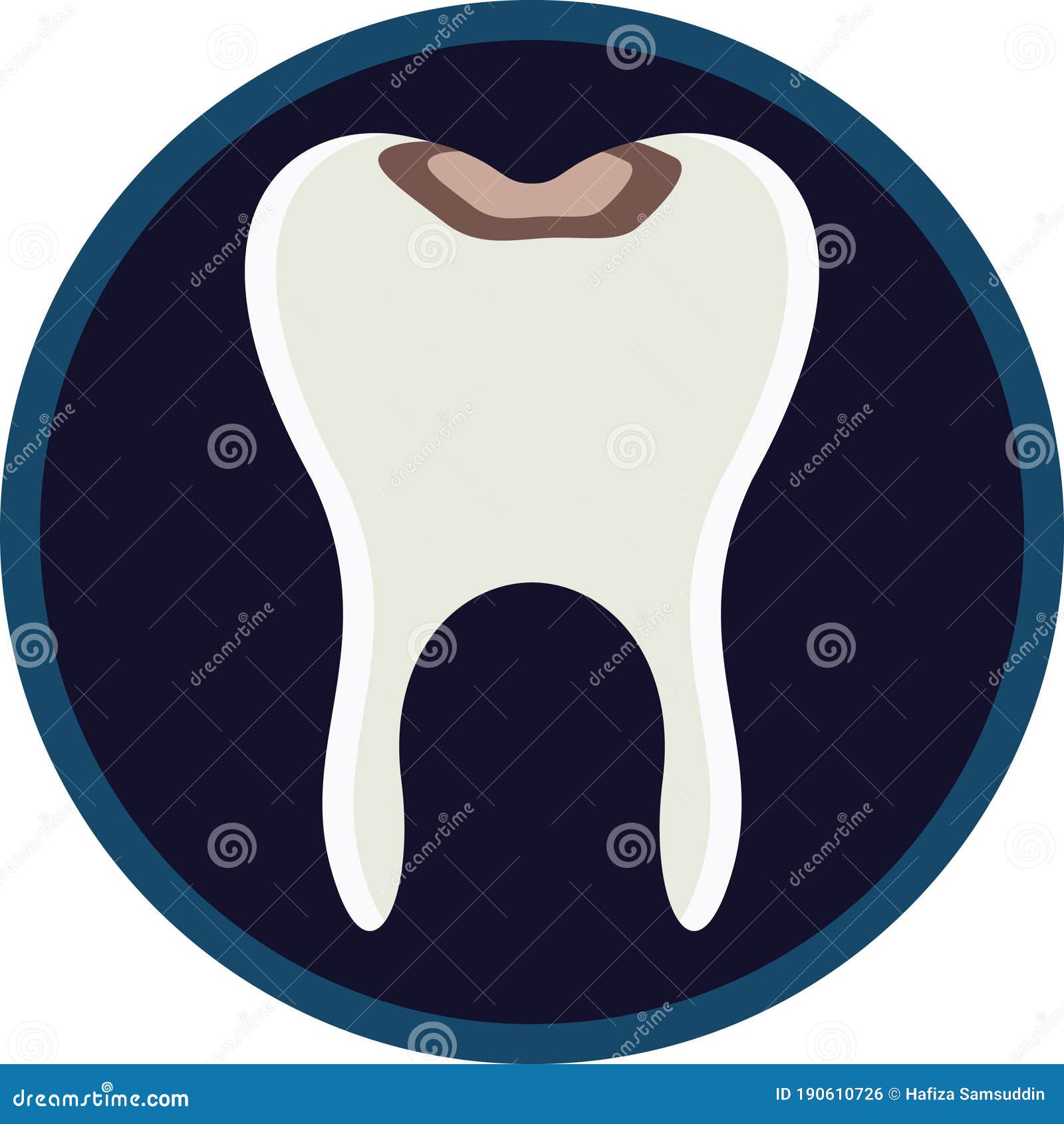 Tooth with Cavity. Vector Illustration Decorative Design Stock Vector ...
