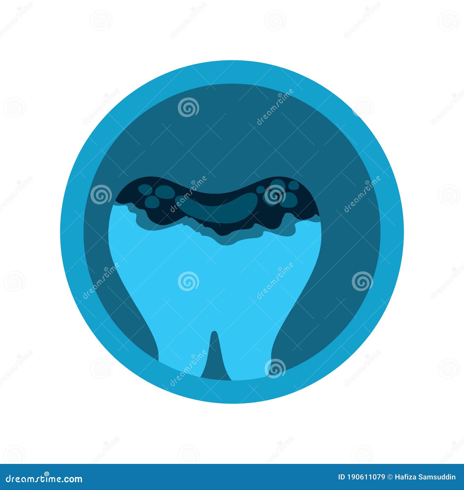 Tooth with Cavity. Vector Illustration Decorative Design Stock Vector ...