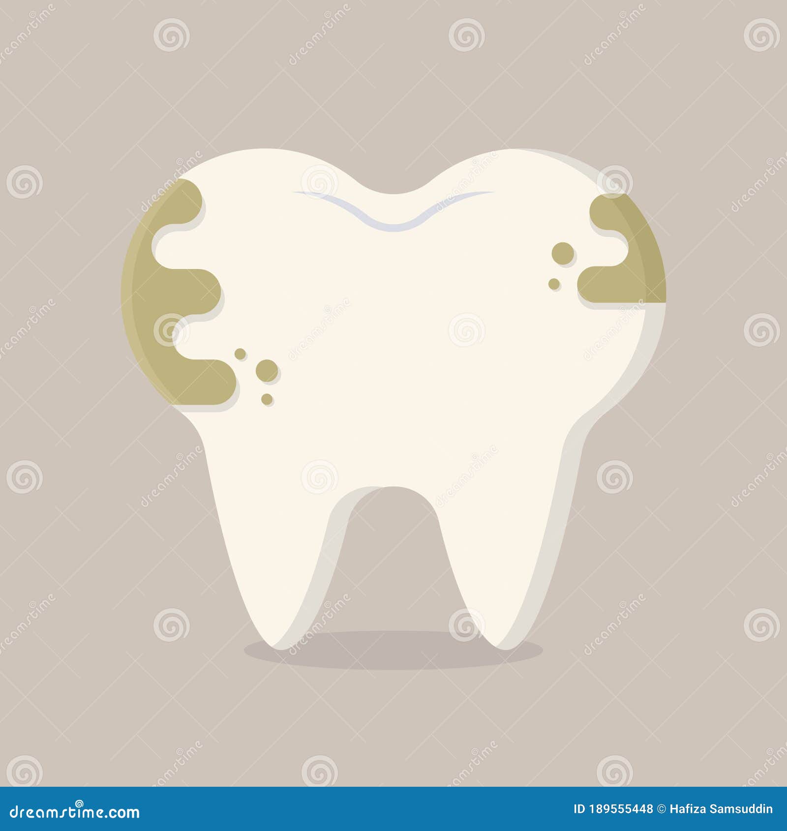Tooth Cavity. Vector Illustration Decorative Design Stock Vector ...