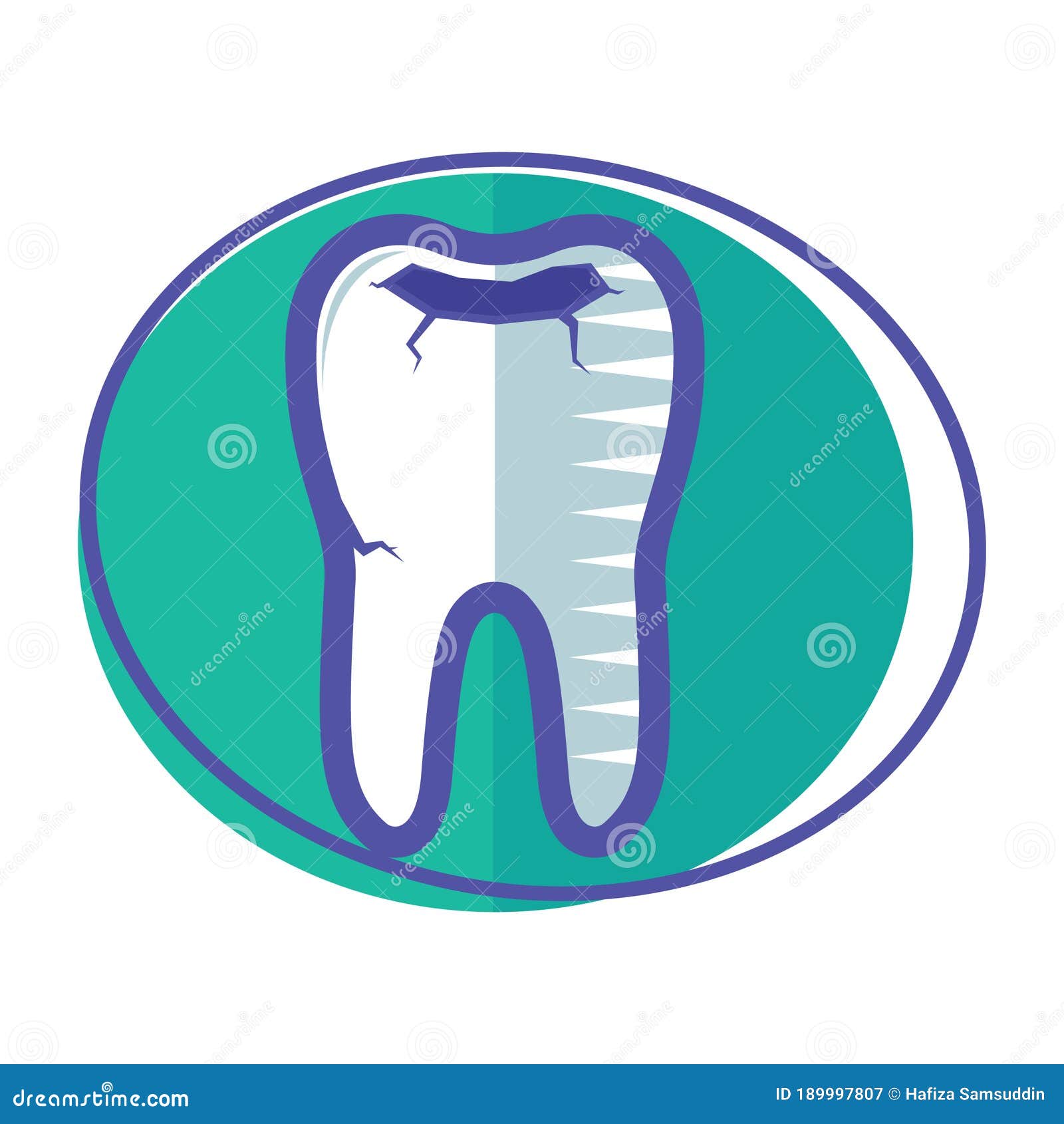 Tooth with Cracks. Vector Illustration Decorative Design Stock Vector ...