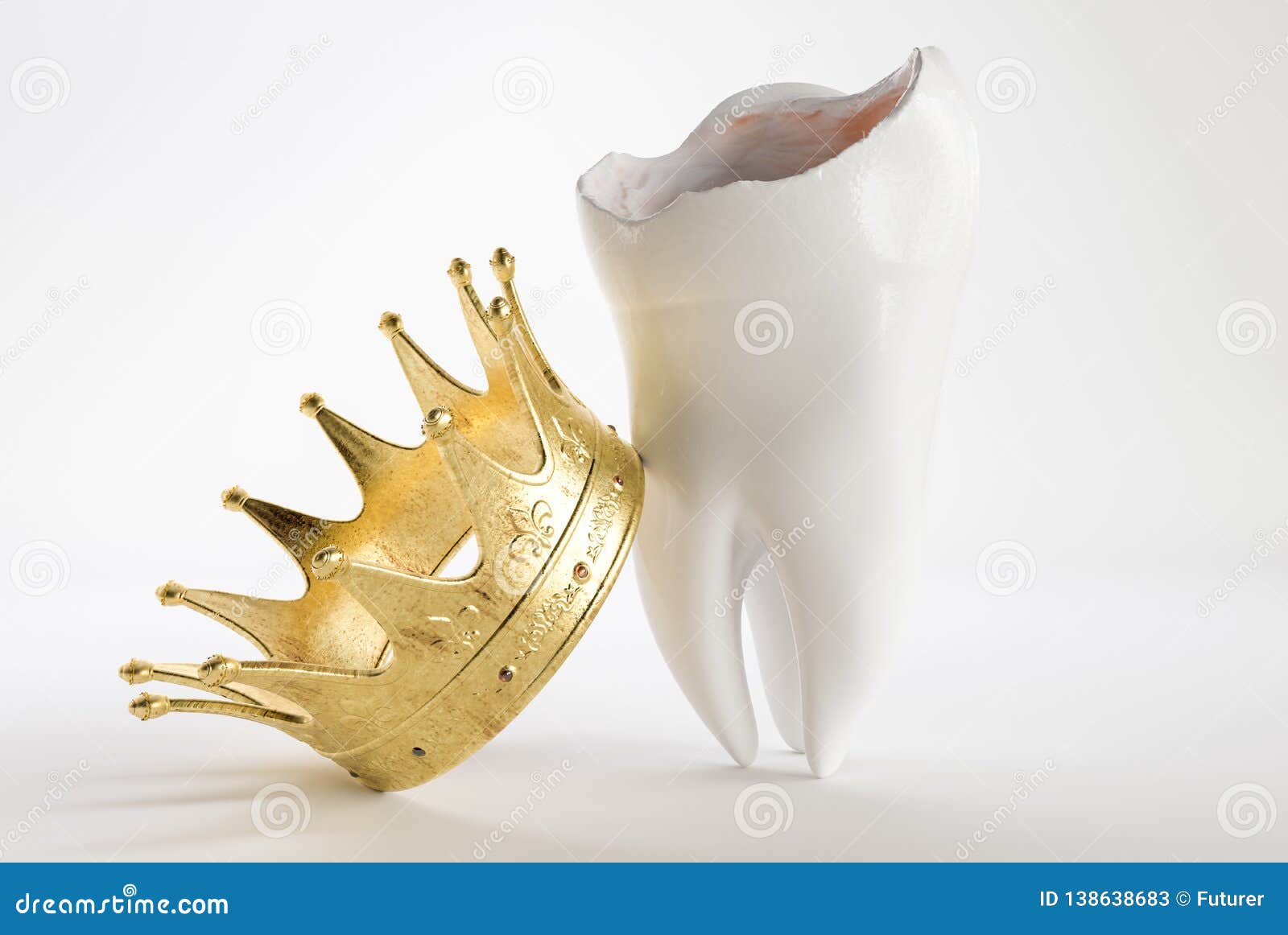 Tooth with a Crown - 3D Rendering Stock Illustration - Illustration of ...