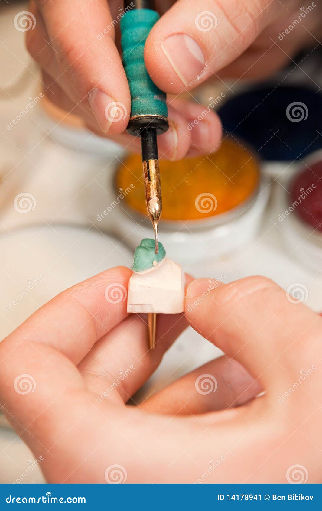 Tooth Crown Waxup process stock image. Image of process - 14178941