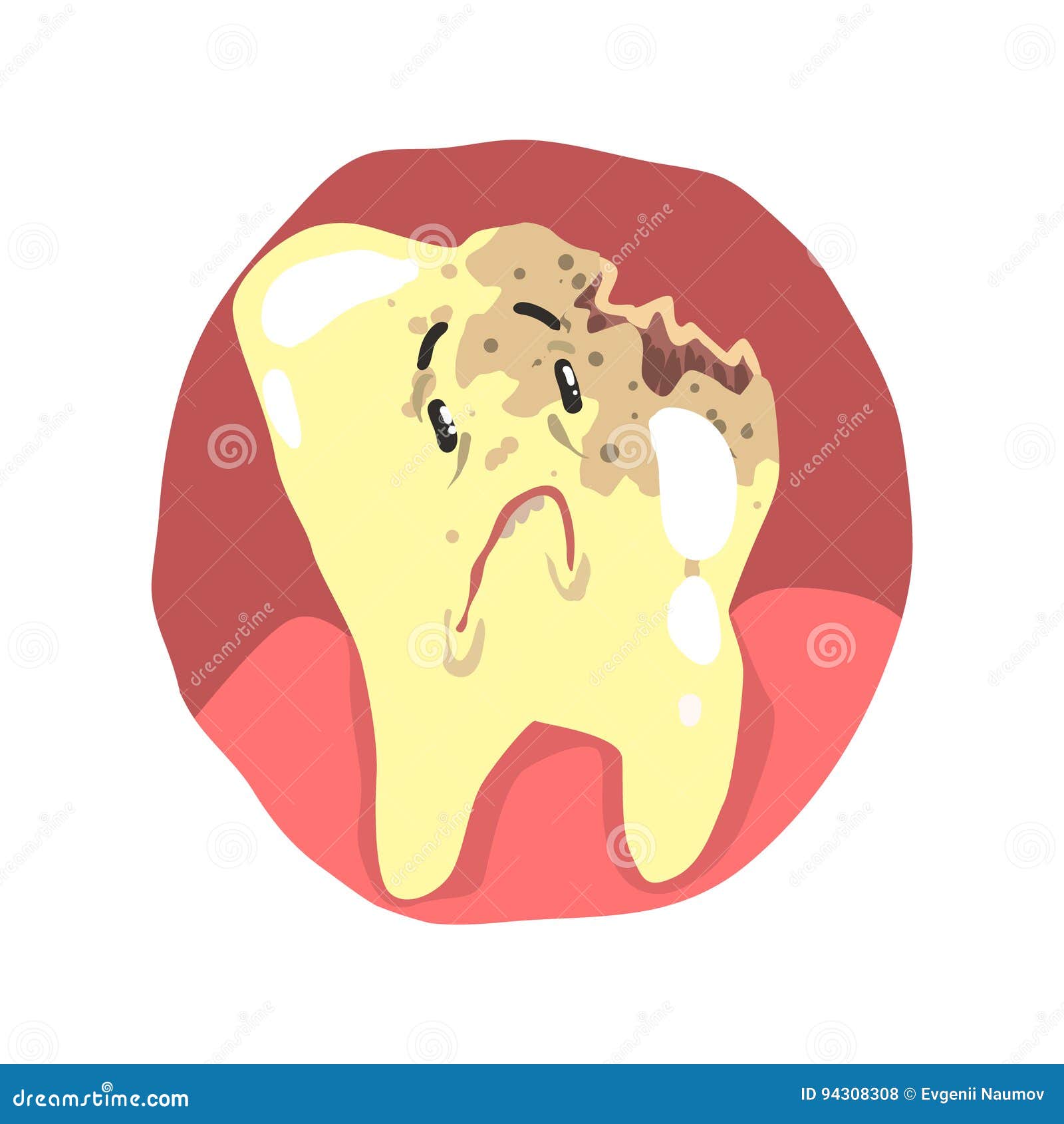 Tooth Decay Cartoon Character with Sad Face Vector Illustration Stock ...