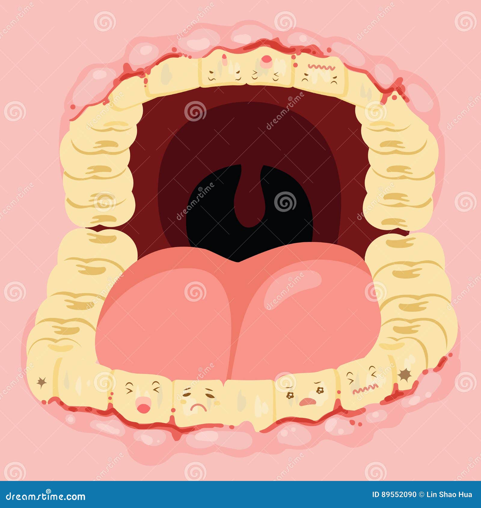 Tooth with decay problem stock vector. Illustration of negative - 89552090