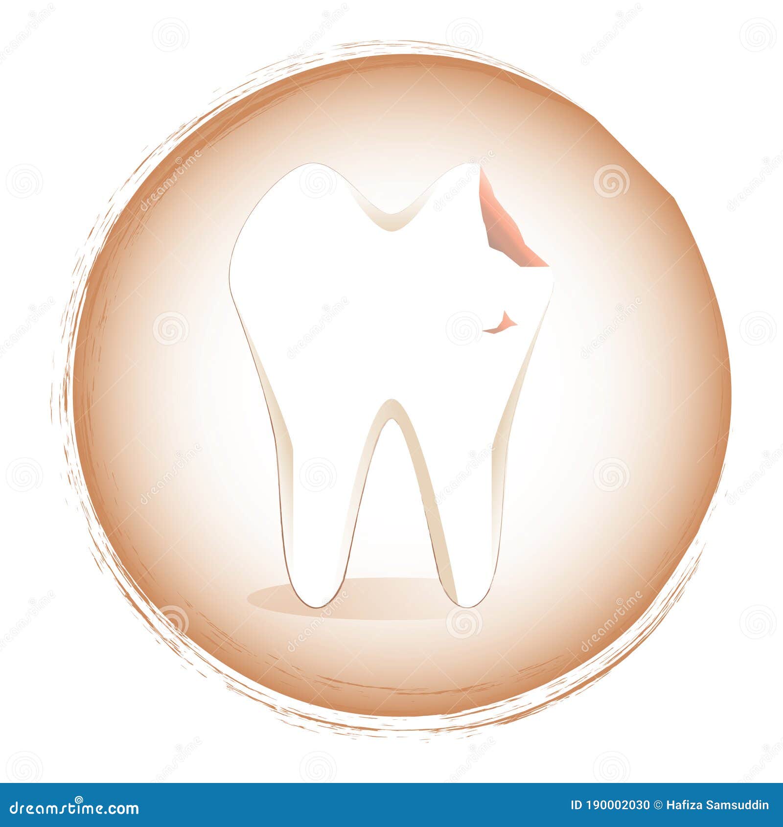 Tooth Decay. Vector Illustration Decorative Design Stock Vector ...