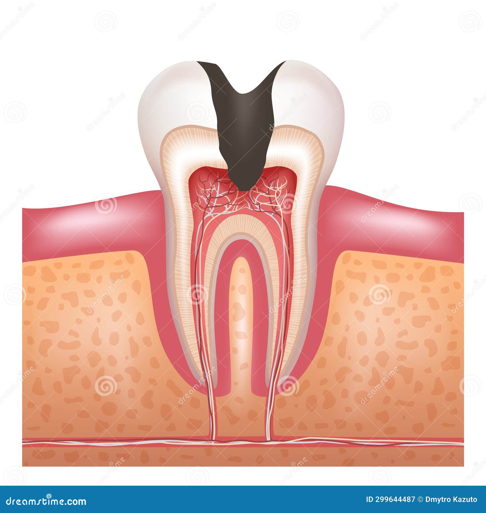 Pulpitis Tooth Problem Vector Illustration | CartoonDealer.com #285678388