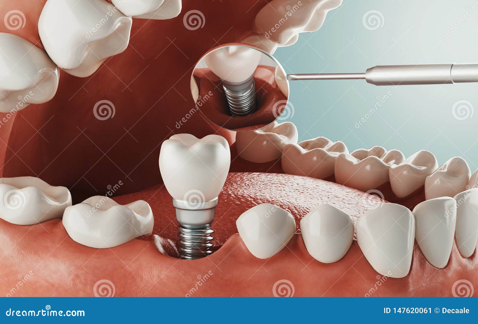 Tooth, Dental Care, 3d Rendering Stock Illustration - Illustration of ...