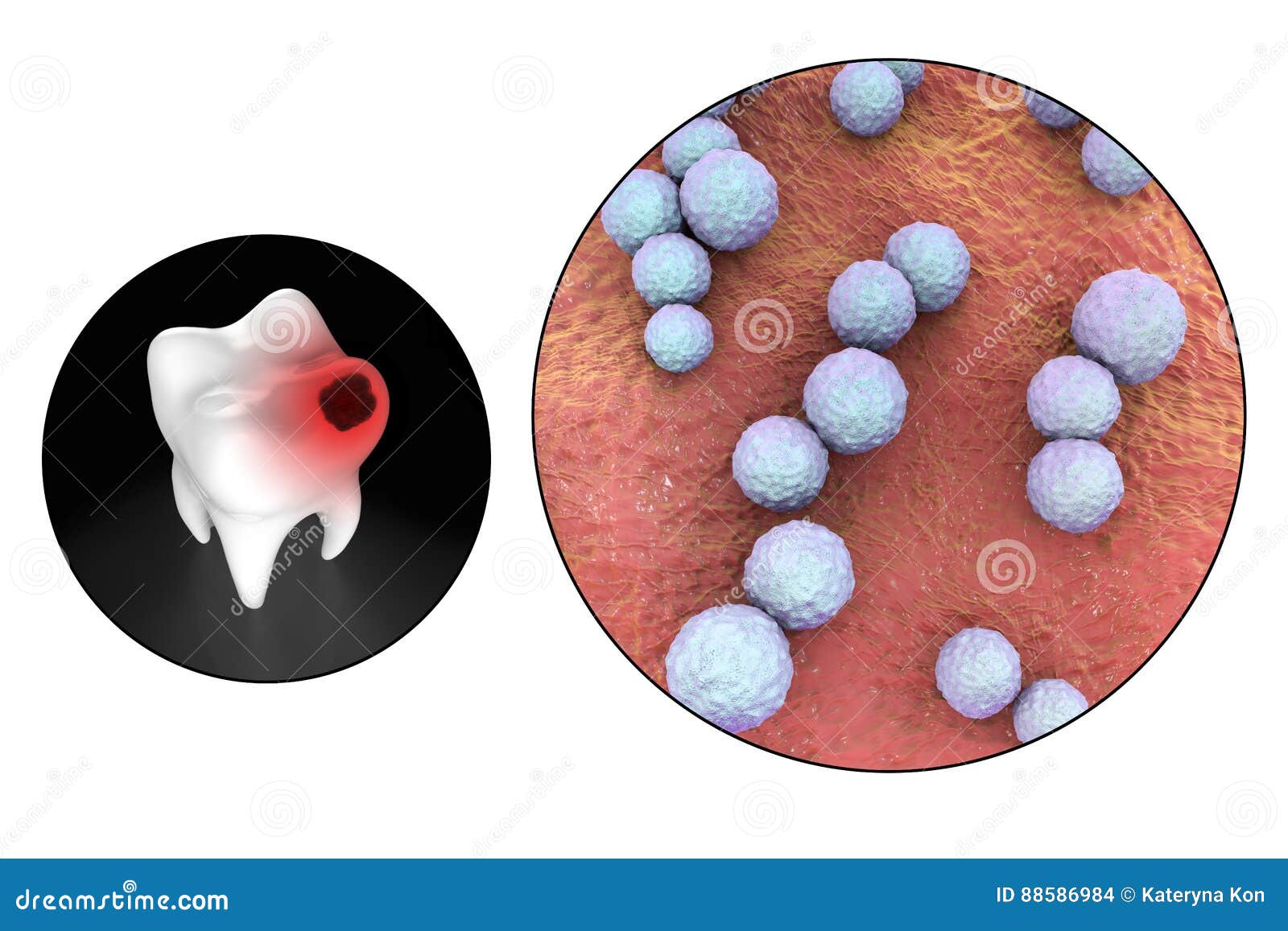 Streptococcus Mutans Bacteria Stock Illustration | CartoonDealer.com ...