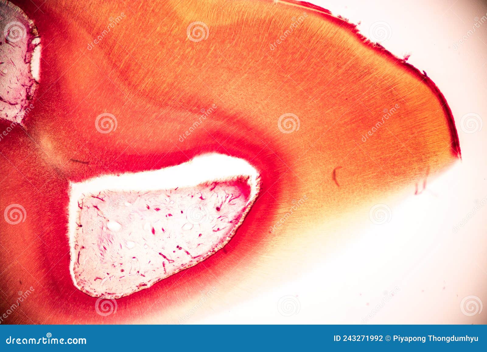 Tooth Development from Human Under Microscope . Stock Photo - Image of ...