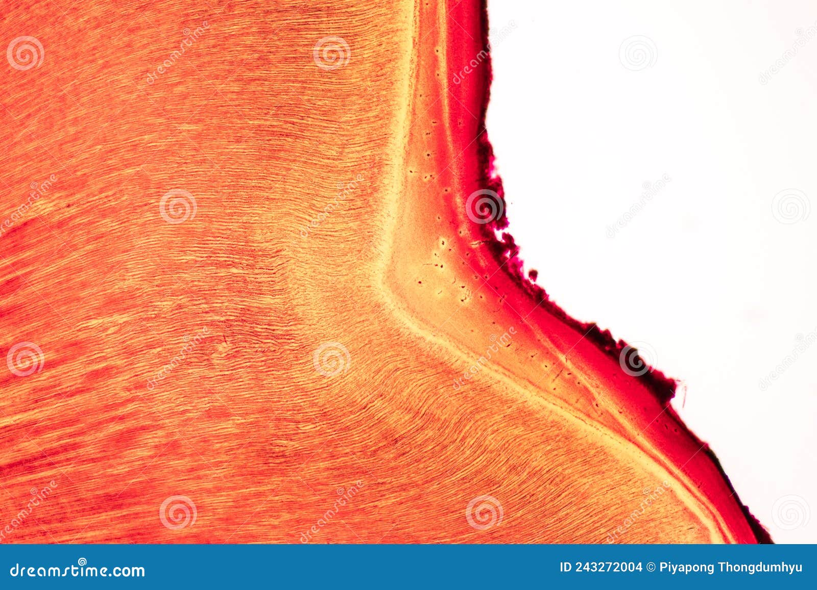 Tooth Development from Human Under Microscope . Stock Photo - Image of ...