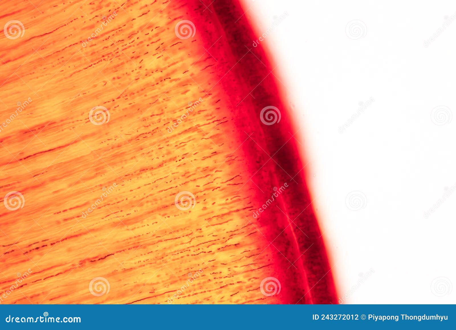 Tooth Development from Human Under Microscope . Stock Photo - Image of ...