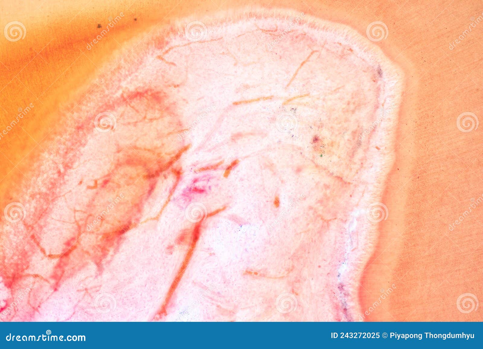 Tooth Development from Human Under Microscope . Stock Image - Image of ...