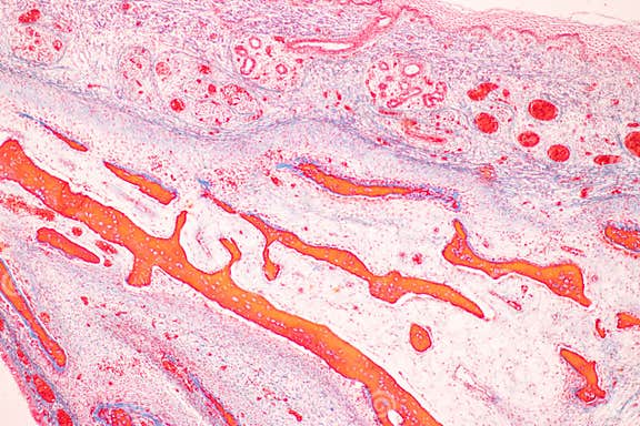 Tooth Development from Human Under Microscope . Stock Photo - Image of ...