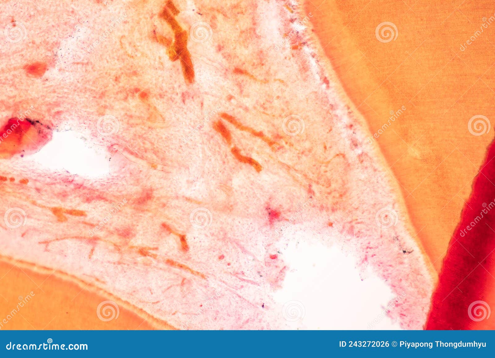 Tooth Development from Human Under Microscope . Stock Photo - Image of ...