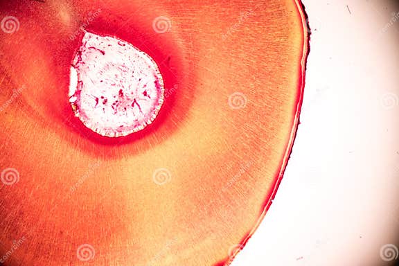 Tooth Development from Human Under Microscope . Stock Photo - Image of ...