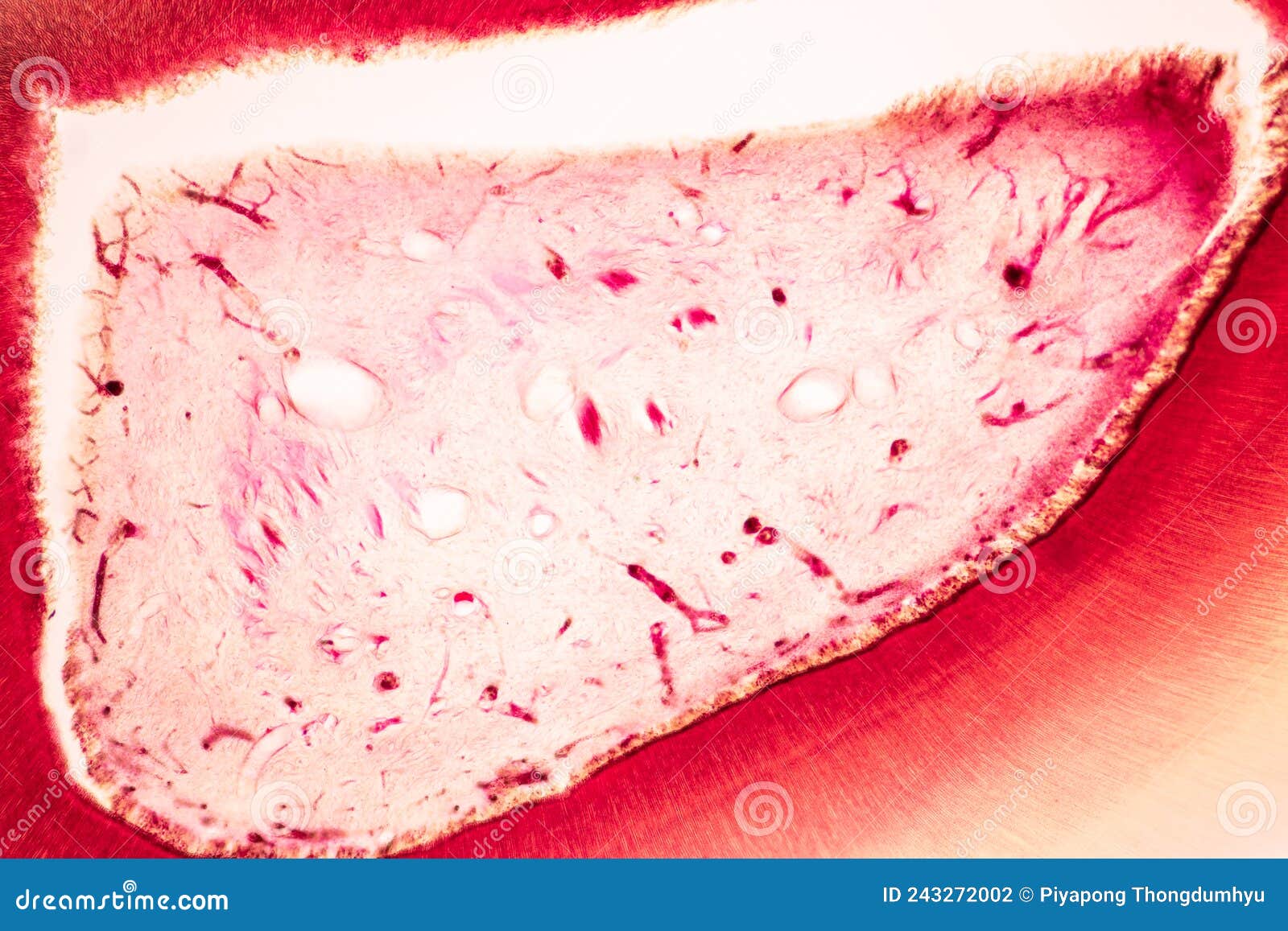 Tooth Development from Human Under Microscope . Stock Photo - Image of ...
