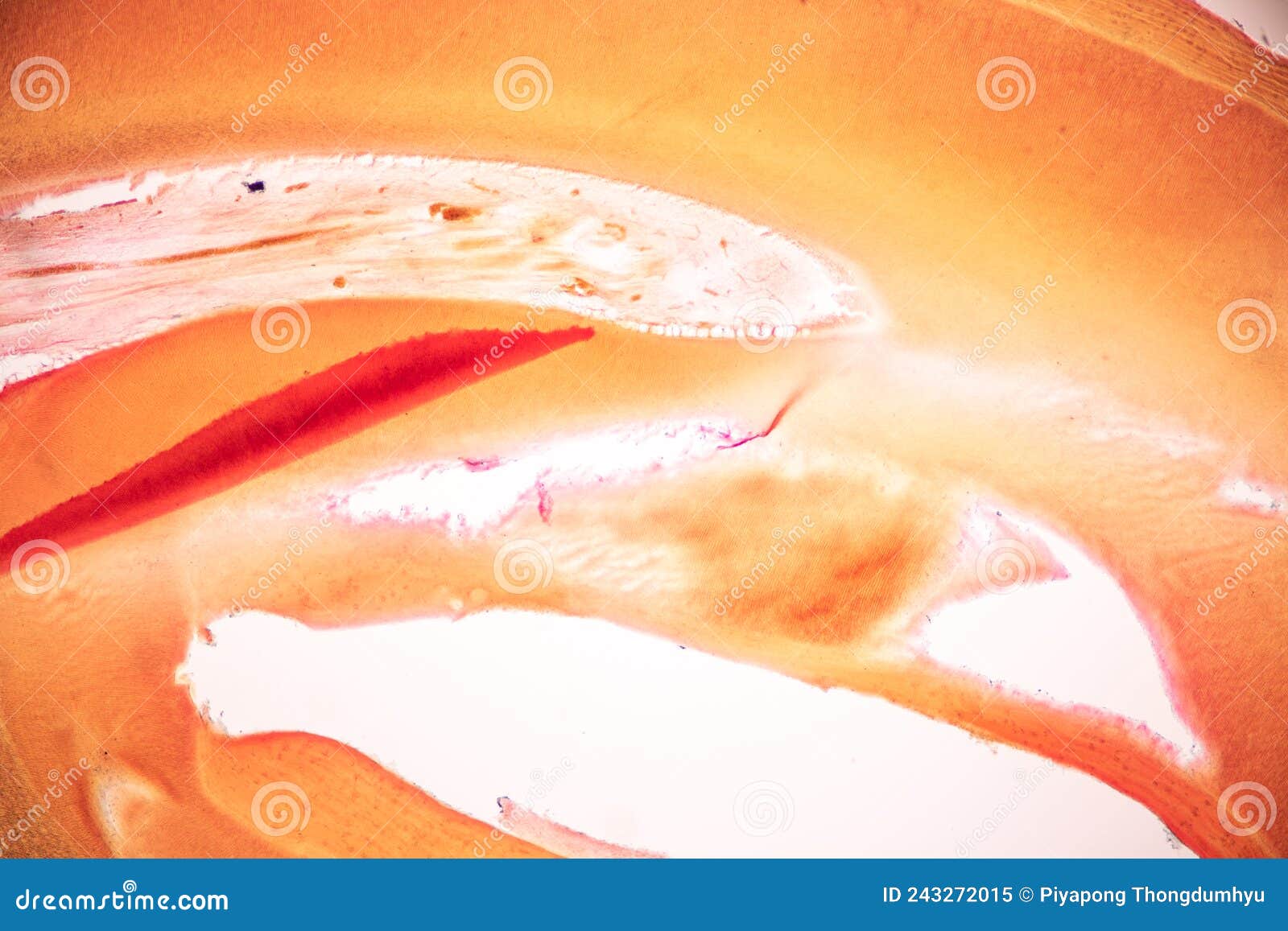 Tooth Development from Human Under Microscope . Stock Image - Image of ...