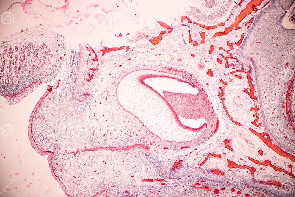 Tooth Development from Human Under Microscope . Stock Image - Image of ...