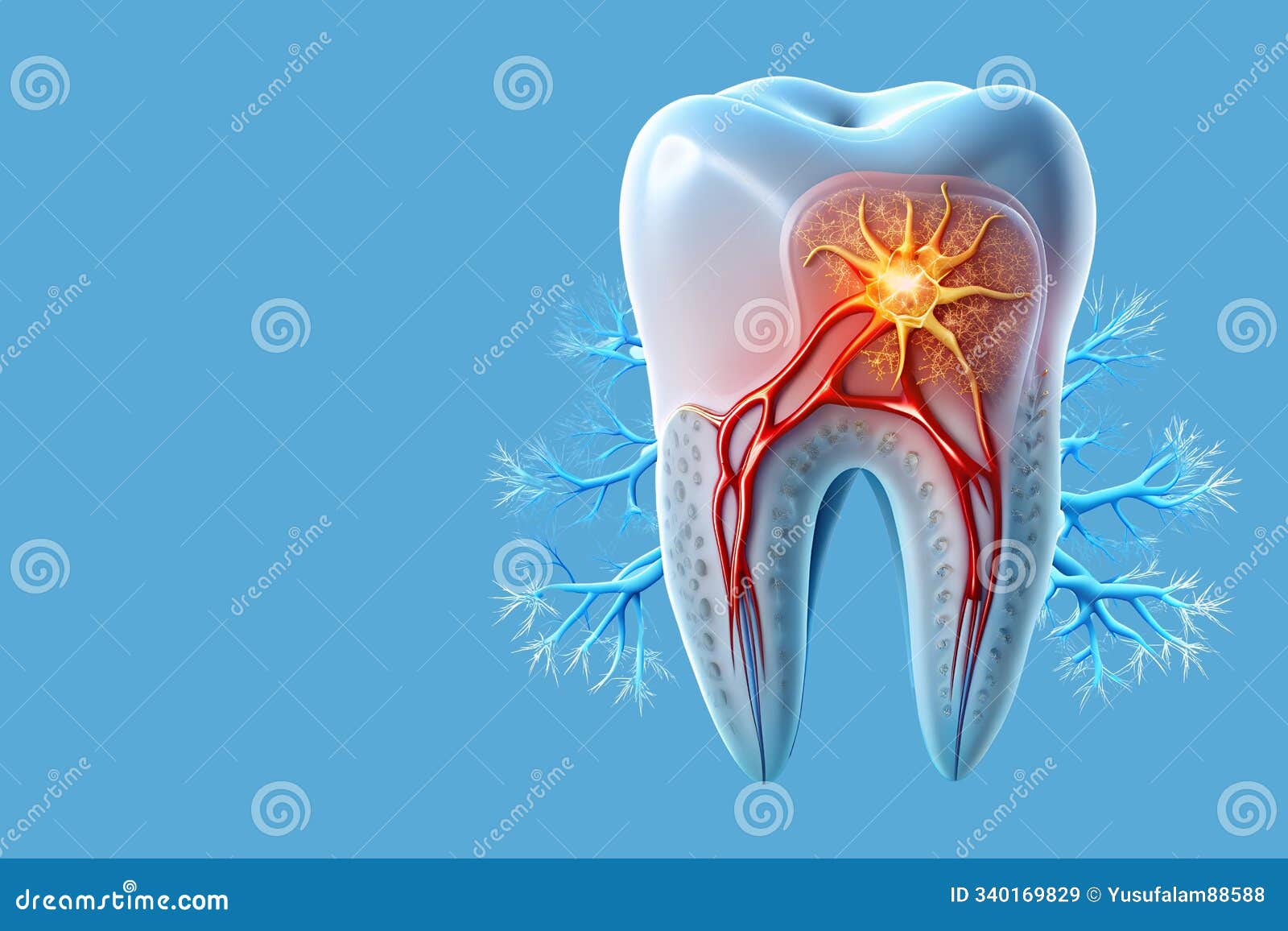 A Tooth With Exposed Nerve Endings Diagram Shows Cold Effects ...