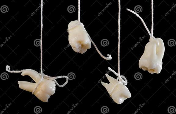 Tooth extracting method stock photo. Image of orthodontic - 12517002