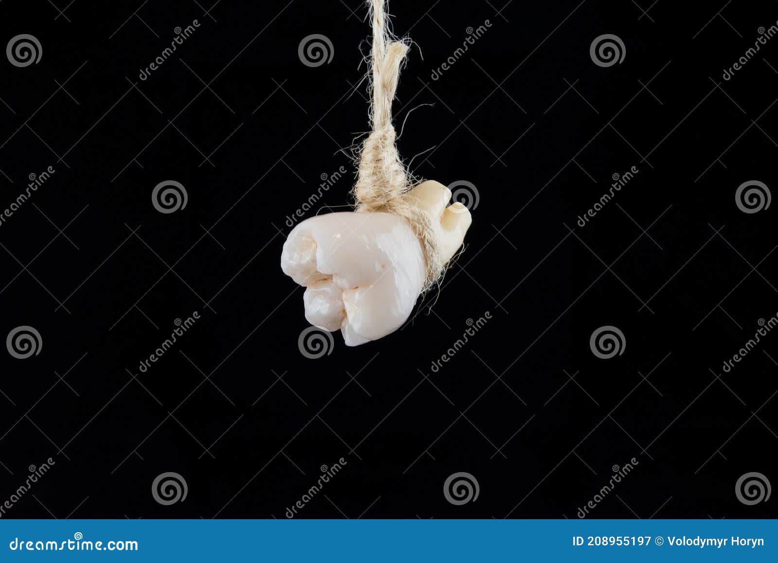 Tooth Extracting Method. Real Human Wisdom Tooth Hanging on Thread ...