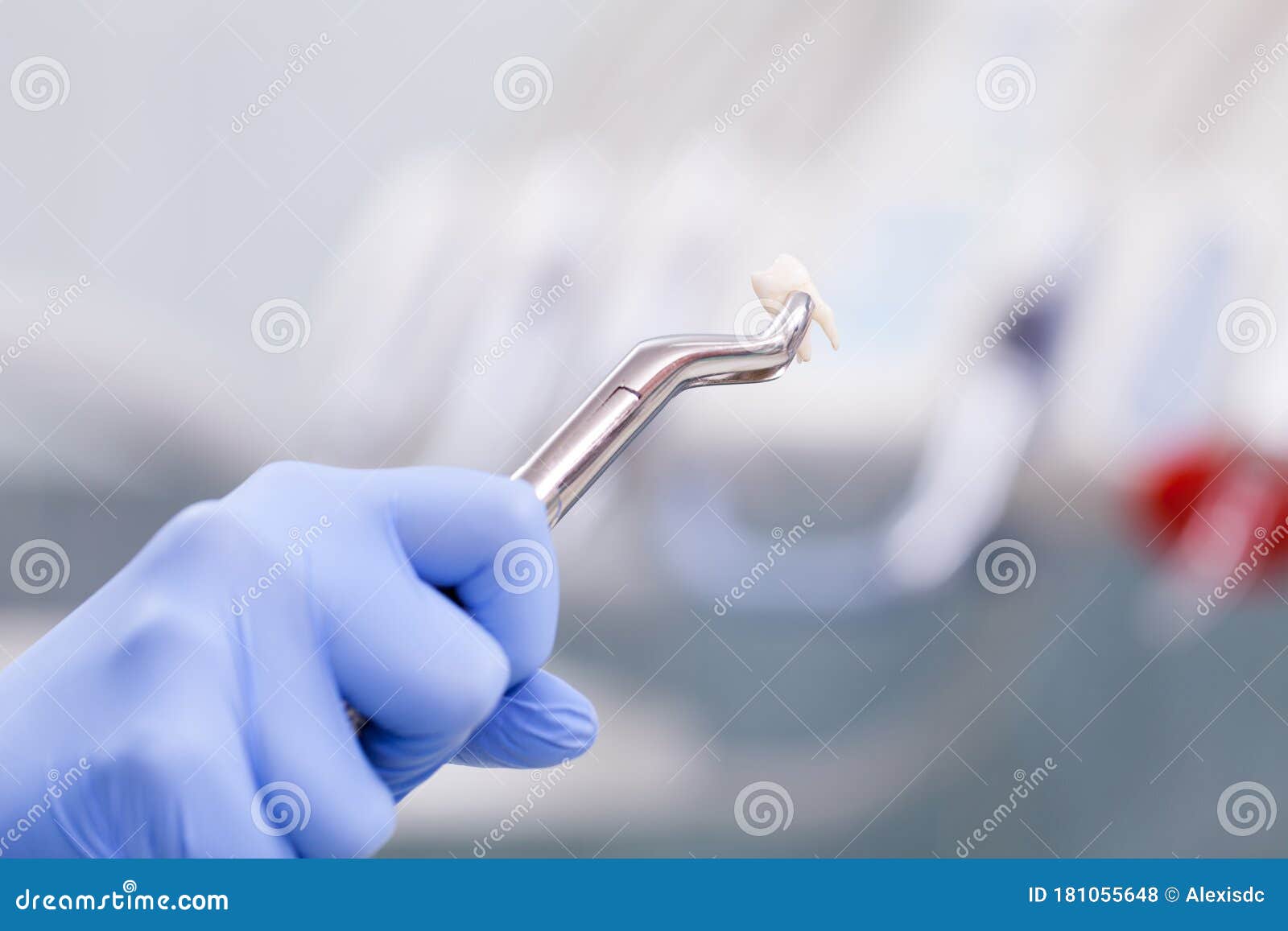 Tooth extraction stock photo. Image of science, healthcare - 181055648