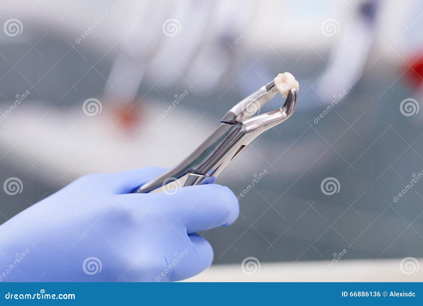 Tooth extraction stock photo. Image of root, illness - 66886136