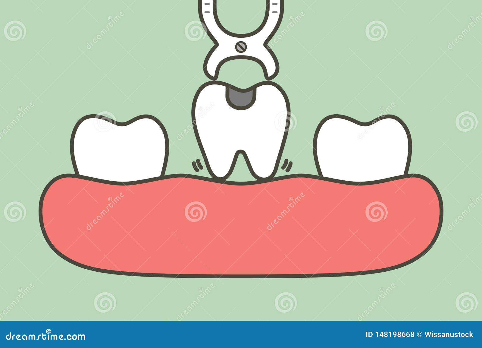 Tooth Extraction by Dental Tools To Remove Decay Tooth Stock Vector ...