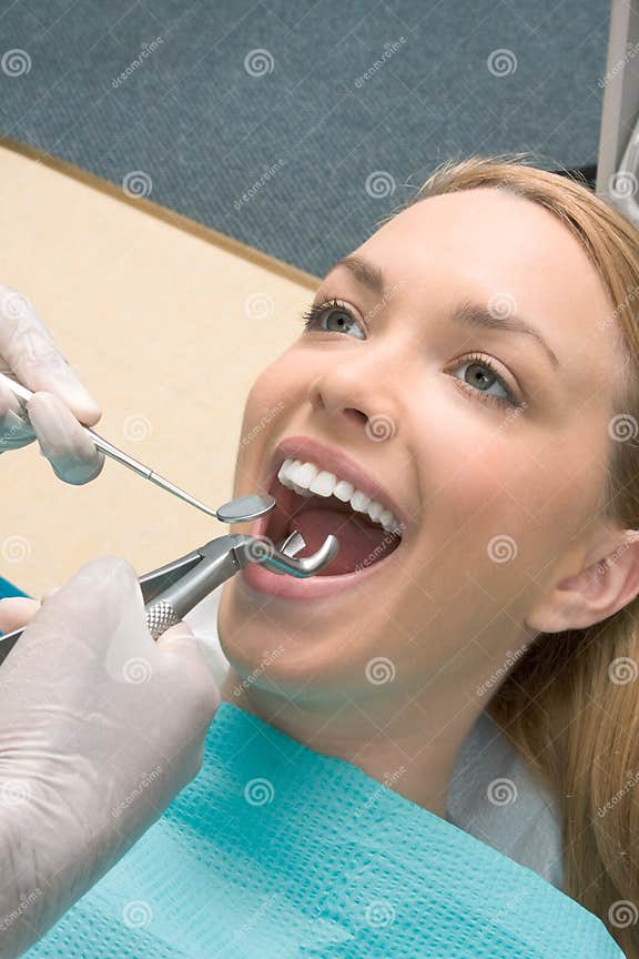 Tooth Extraction by Dentist Using Forceps Stock Photo - Image of glove ...