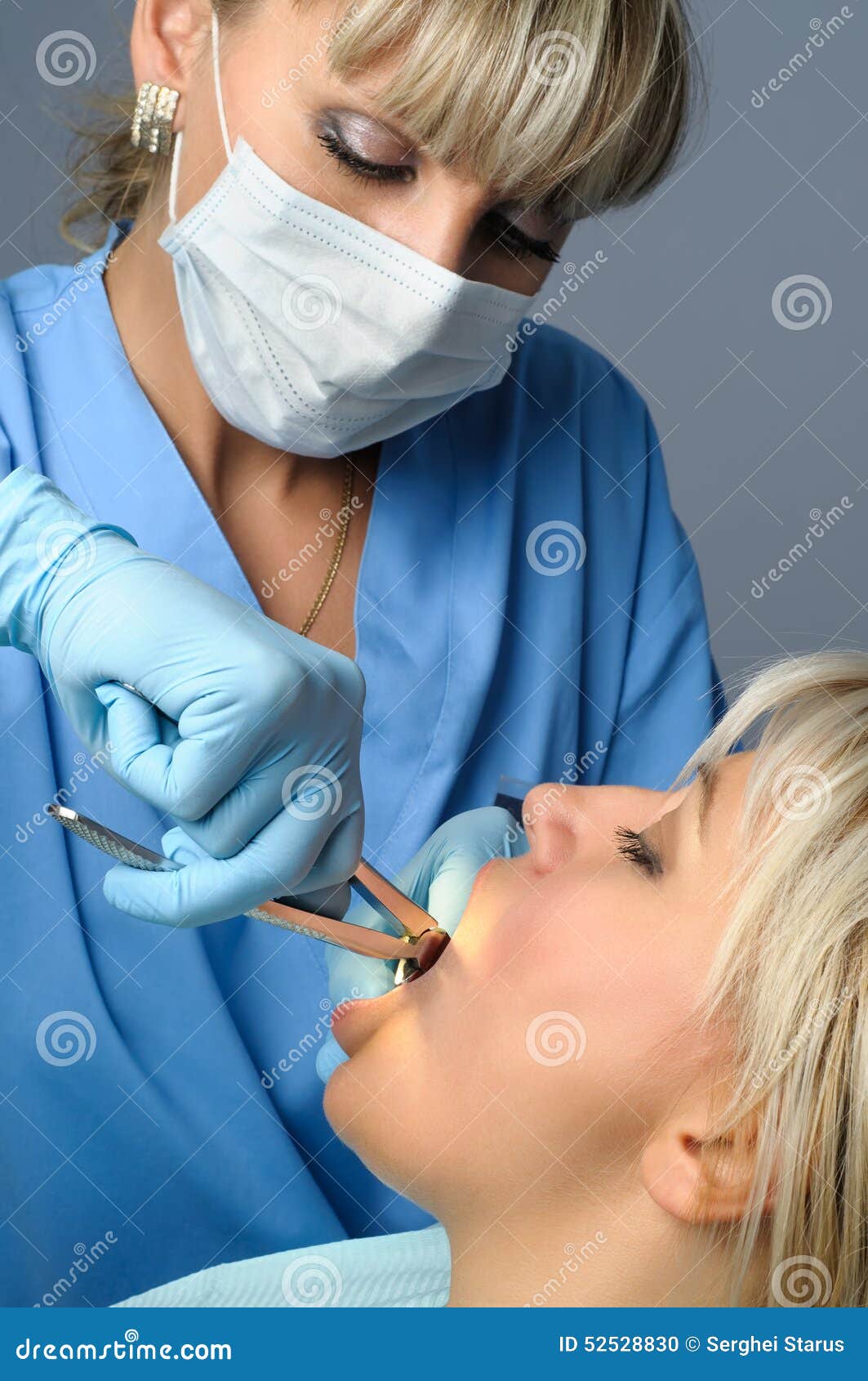Tooth extraction stock photo. Image of human, removal - 52528830