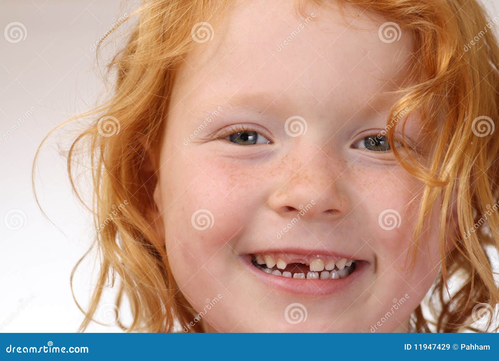 Tooth gap stock image. Image of laughter, motion, motivated - 11947429