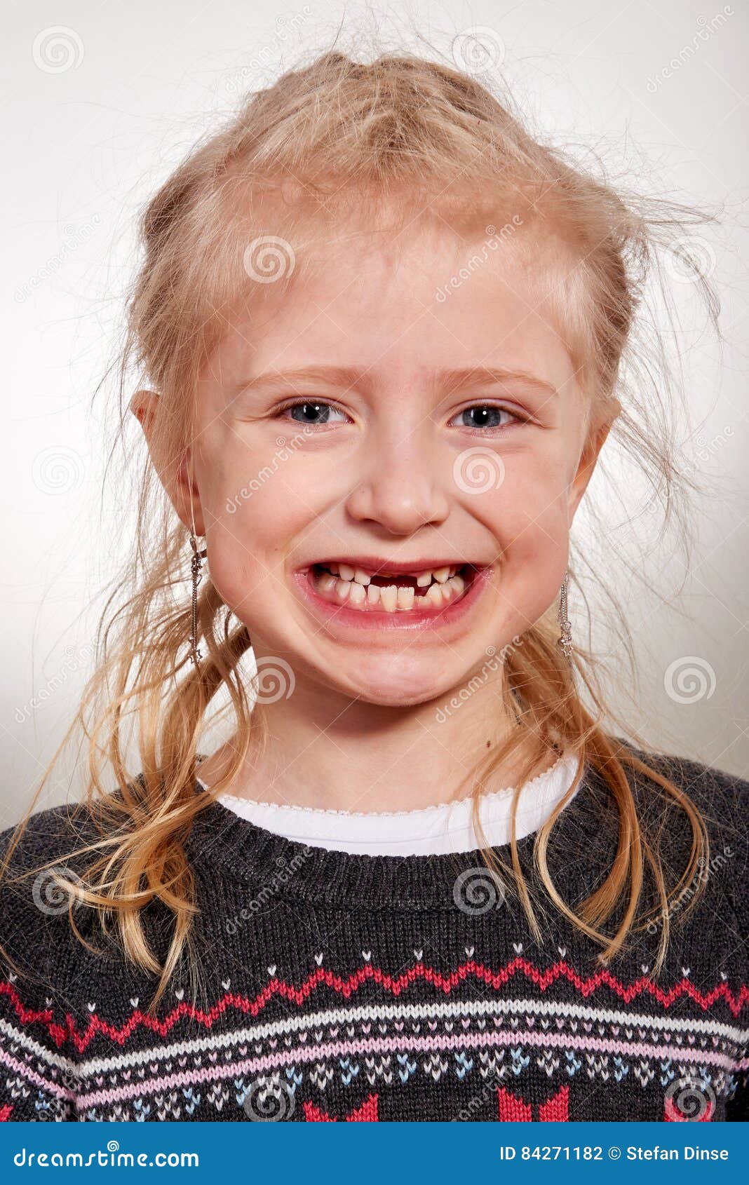 Tooth gap stock photo. Image of lips, girl, grin, dentistry - 84271182