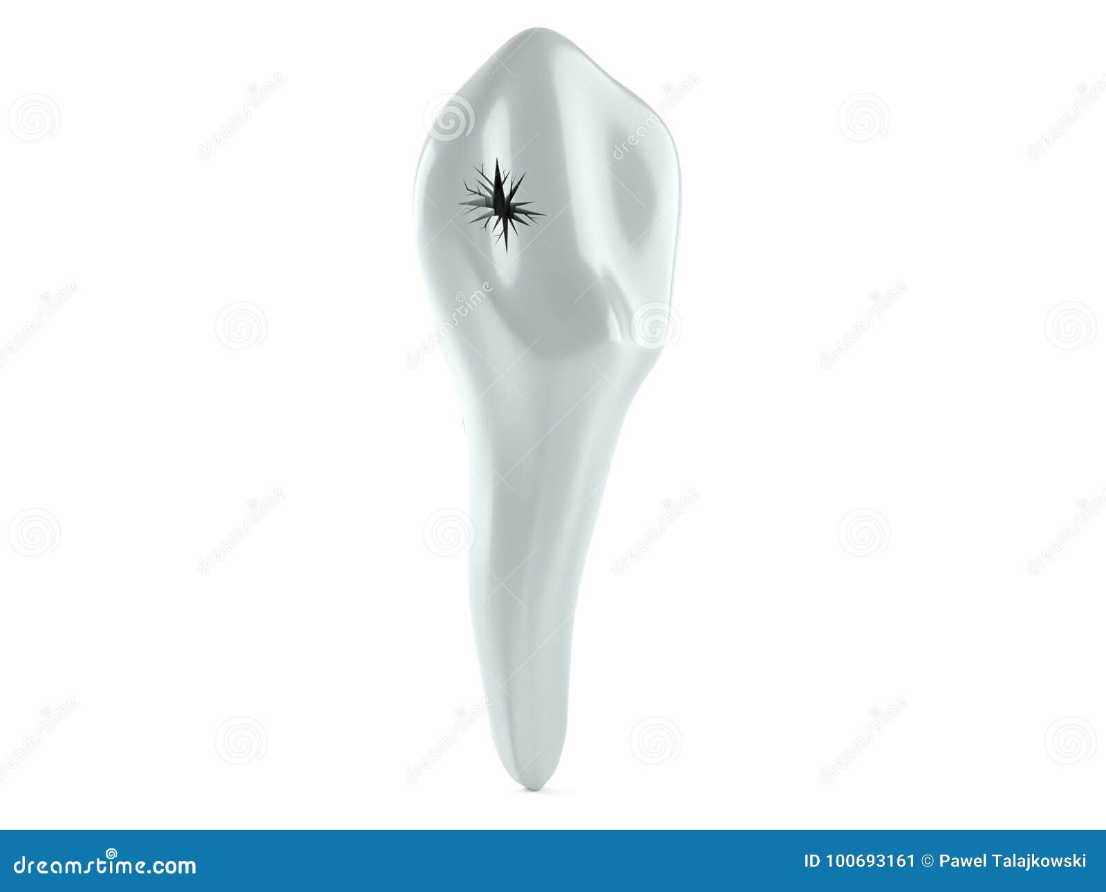 Tooth With Hole. Sick Tooth. Caries And Pulpitis Toothache Vector ...