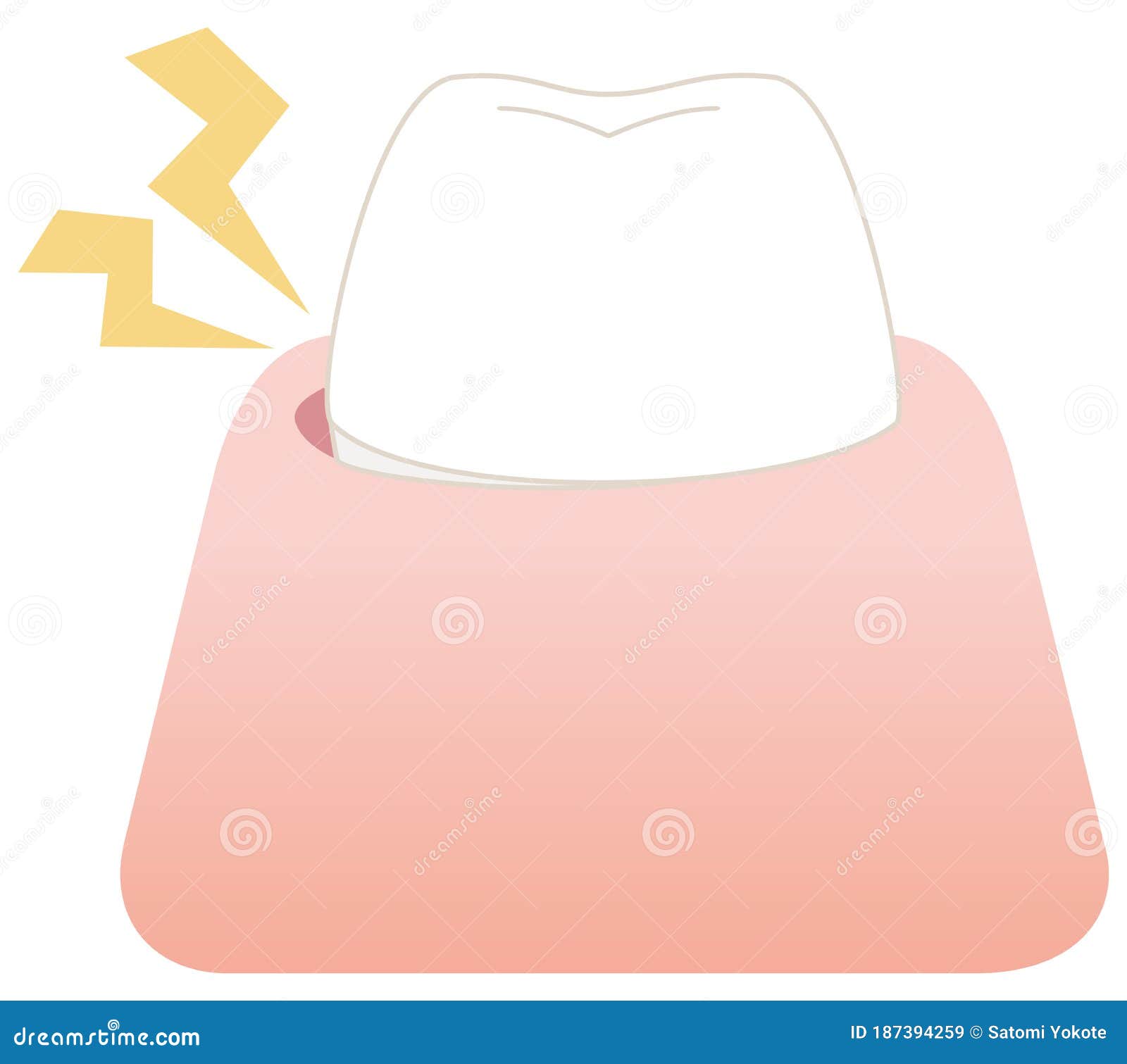 Tooth Illustration with Gaps in the Gums Stock Vector - Illustration of ...