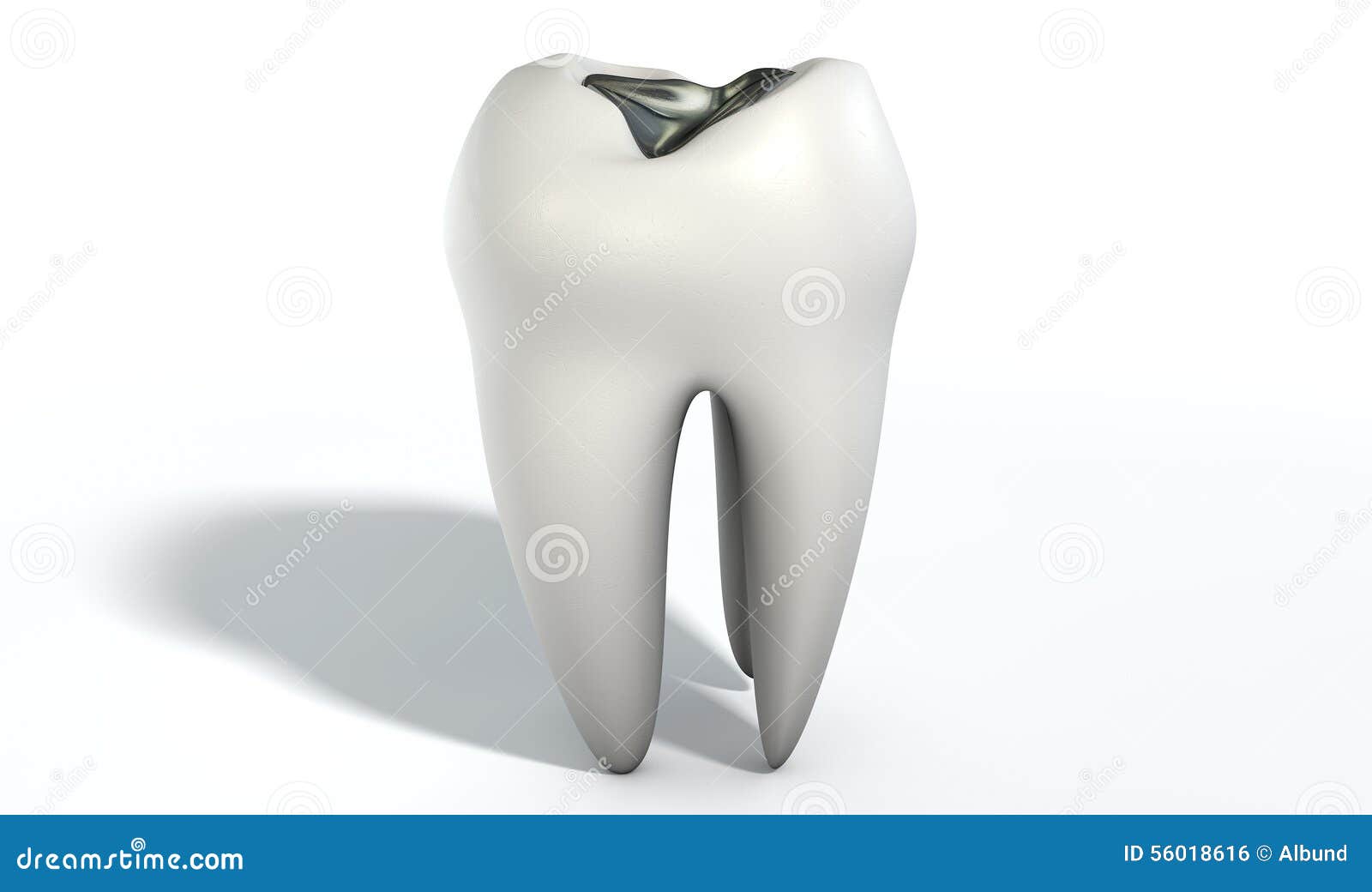 Tooth with Lead Filling stock photo. Image of incisor - 56018616