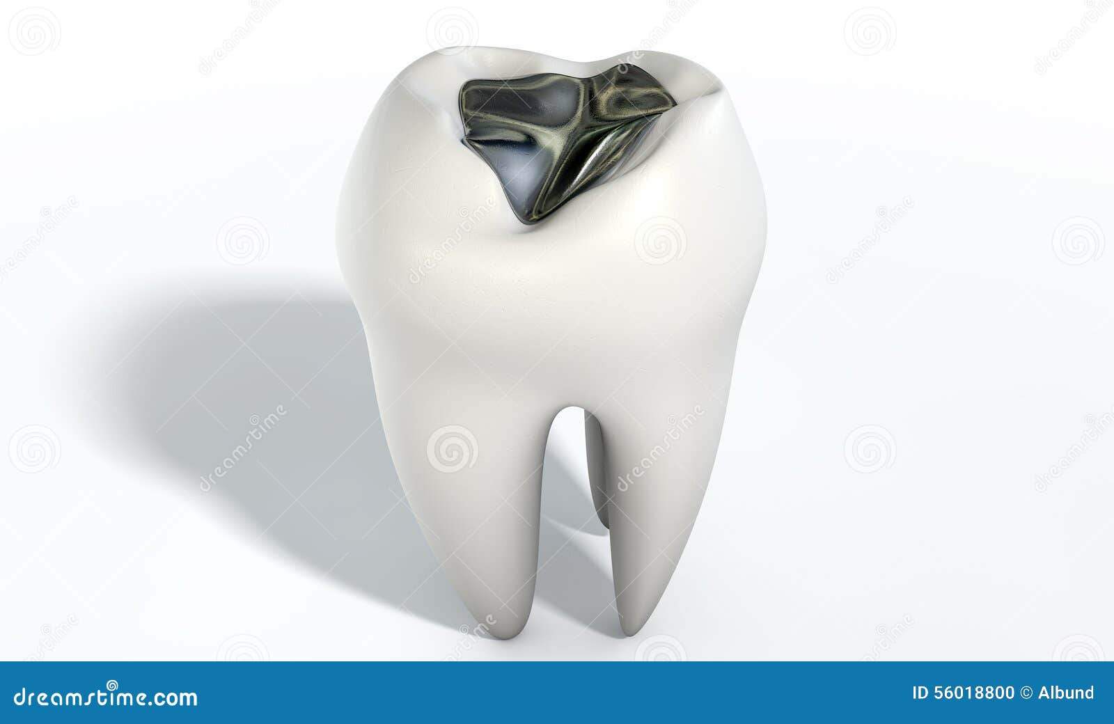 Tooth with Lead Filling stock illustration. Illustration of canine ...