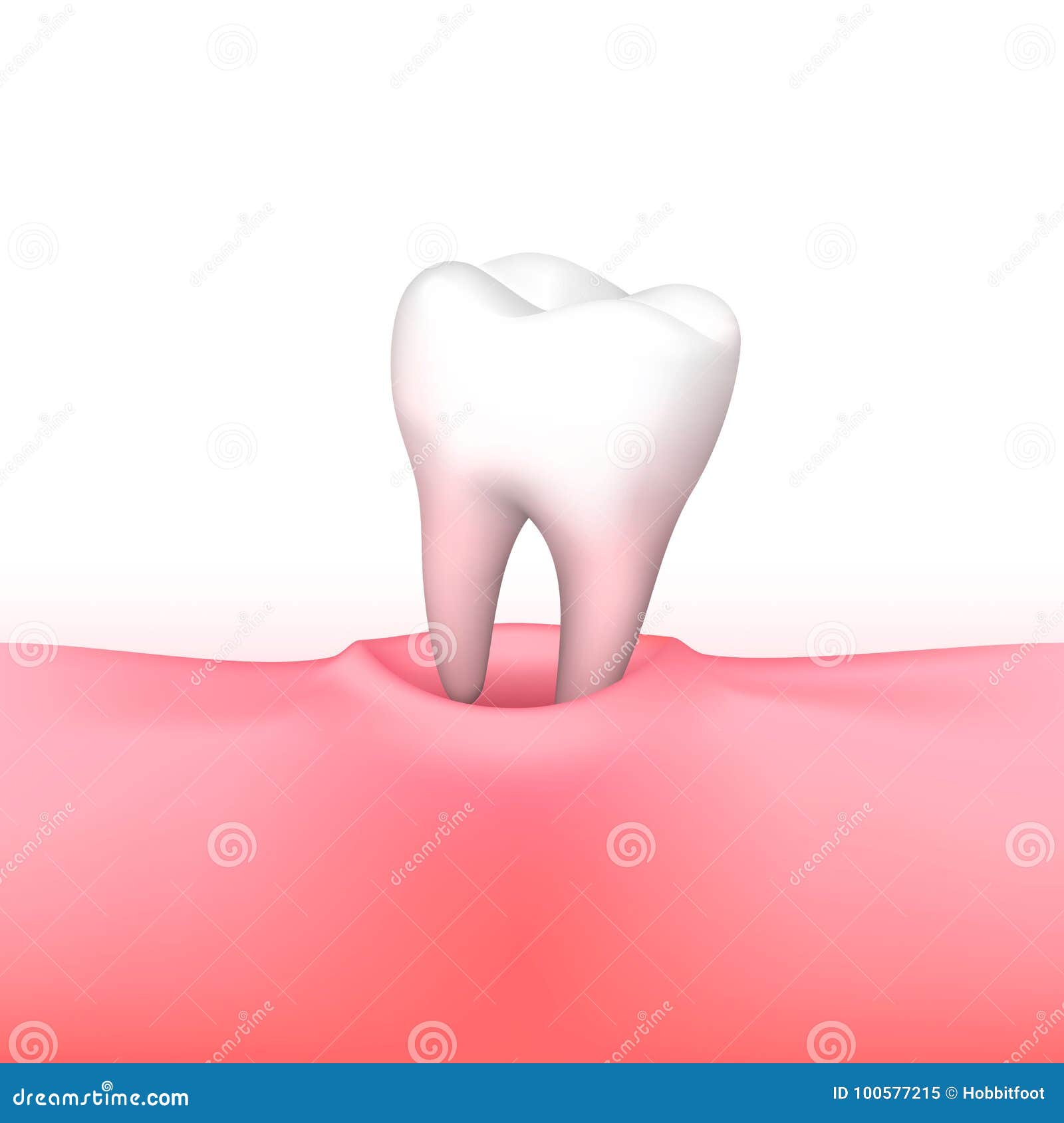 Tooth Loss on White Background. Stock Vector - Illustration of healthy ...