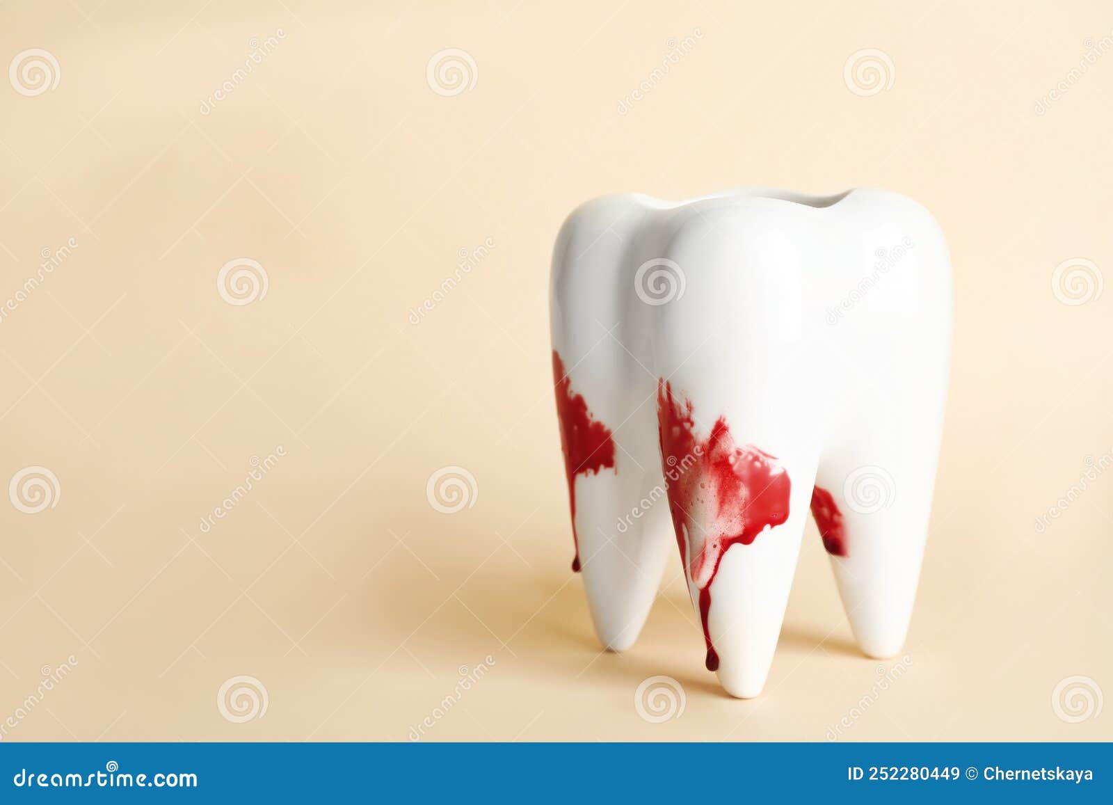 Tooth Model with Blood in Toothpaste Foam on Beige Background, Space ...