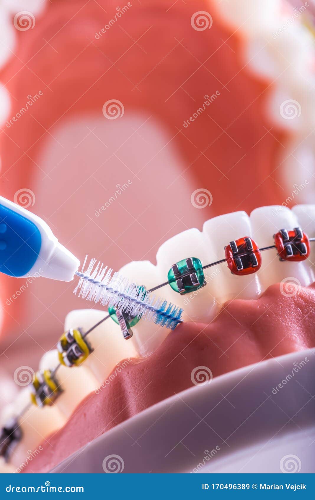 Tooth Model from Dental Braces with Inter Dental Teeth Cleaning Brush ...