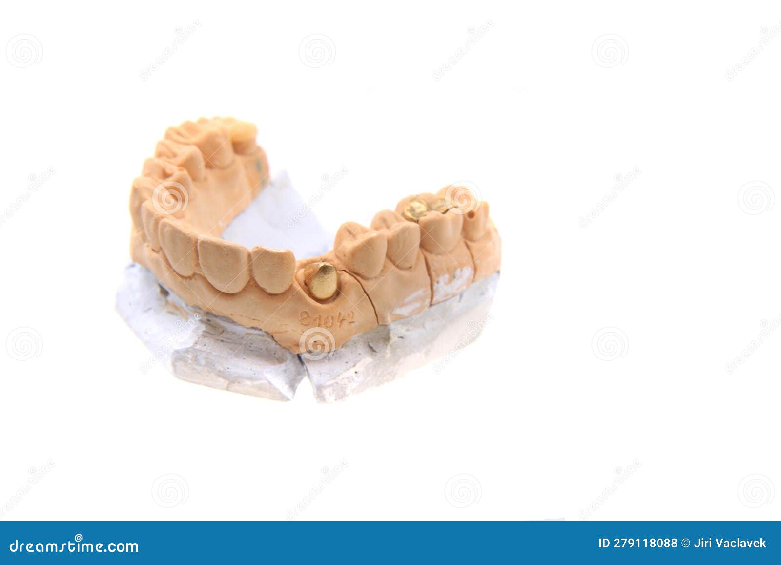 Tooth Model Objects from Dentist School Stock Photo - Image of model ...