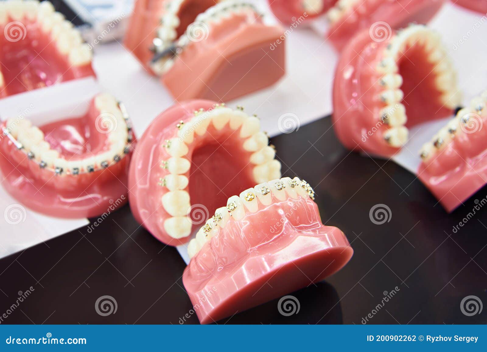 Tooth models with braces stock photo. Image of color - 200902262